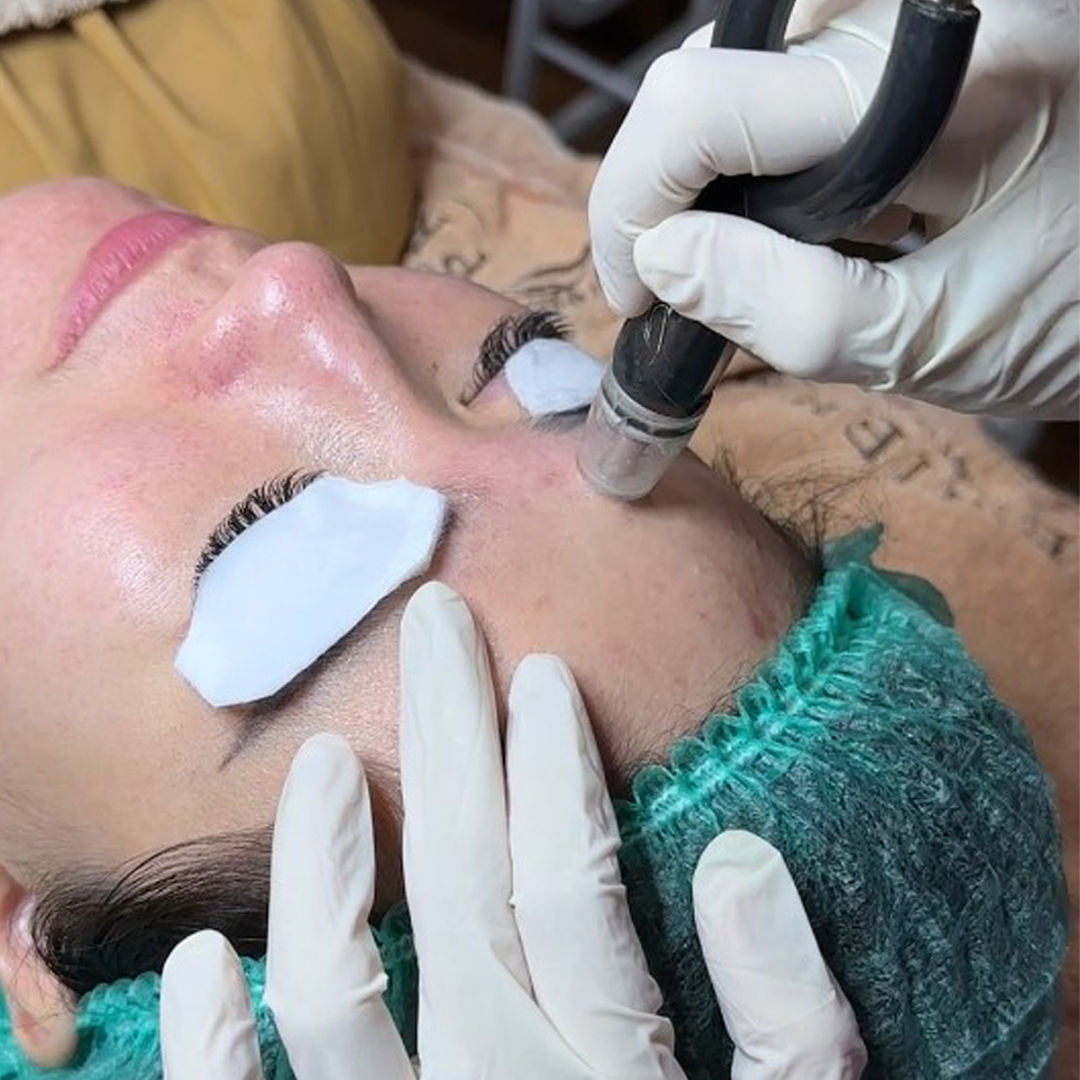 PREMIER SilkPeel DermalInfusion by PREMIERA Skin & BodyCare ...