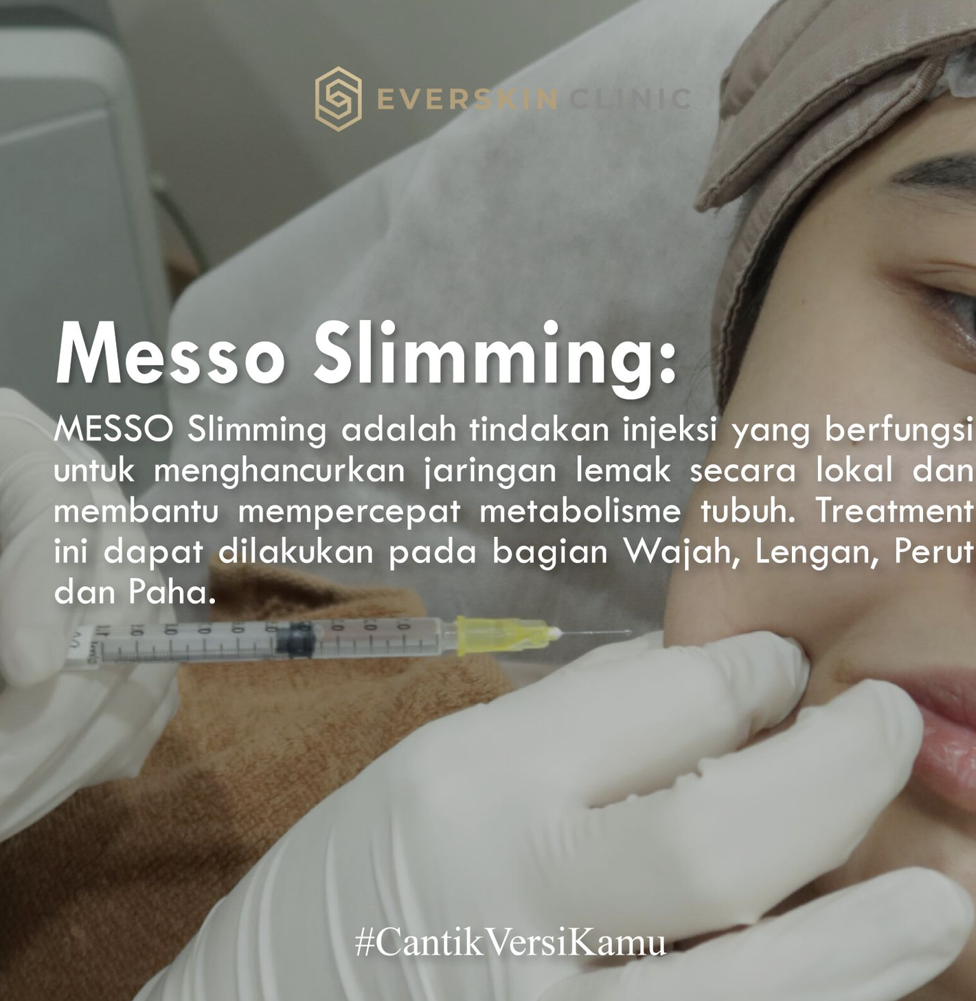Messo Slimming | Everskin | Bridestory