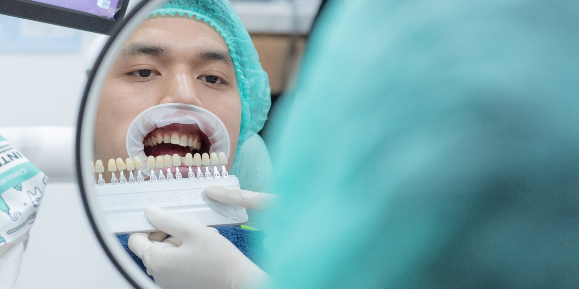 Toot Whitening (Bleaching) by Dental Inc | Bridestory Store