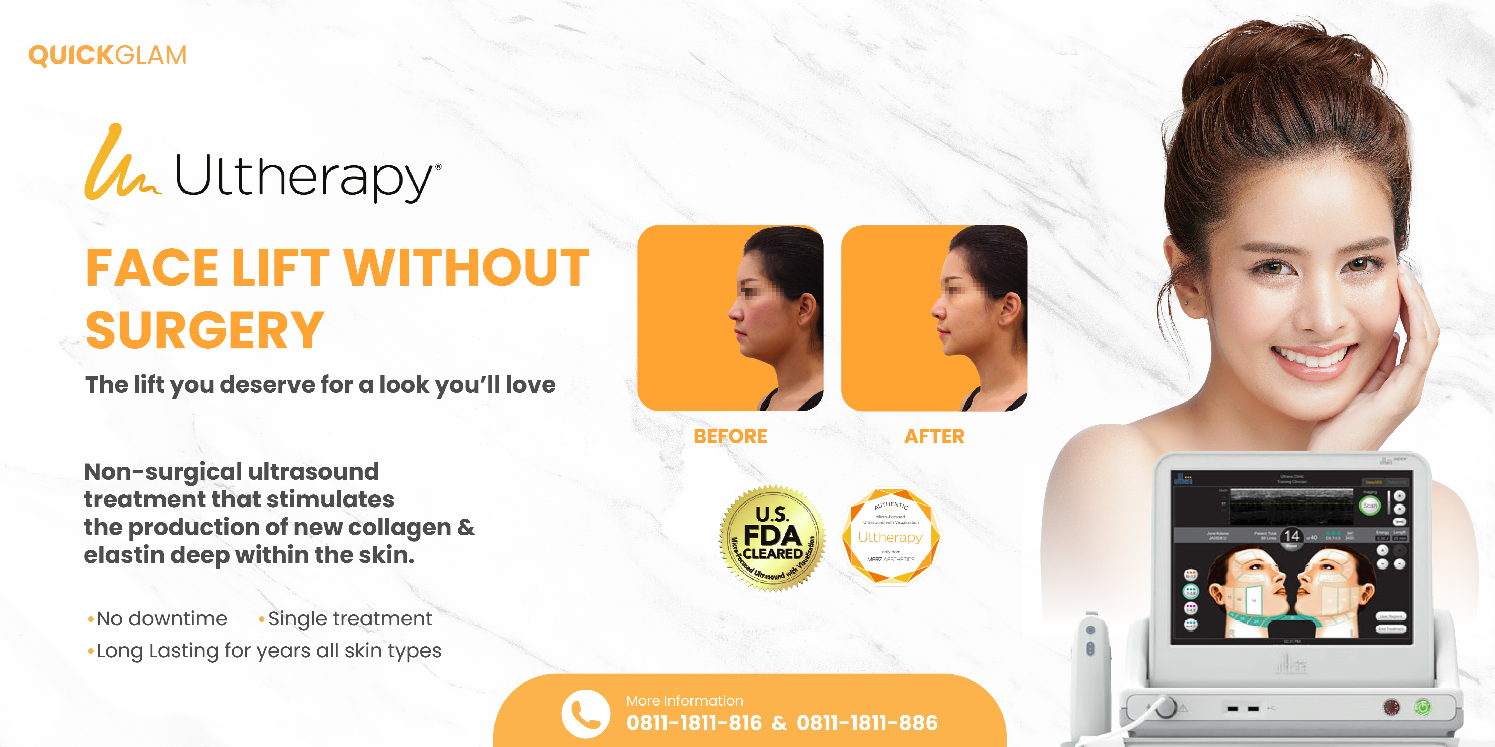 Ultherapy Treatment oleh Quickglam Clinic | Bridestory Store